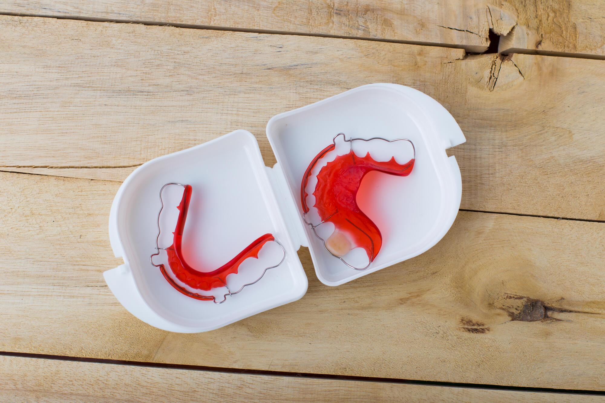 How Long Do You Have to Wear a Retainer: What to Know - Orthodontics by ...